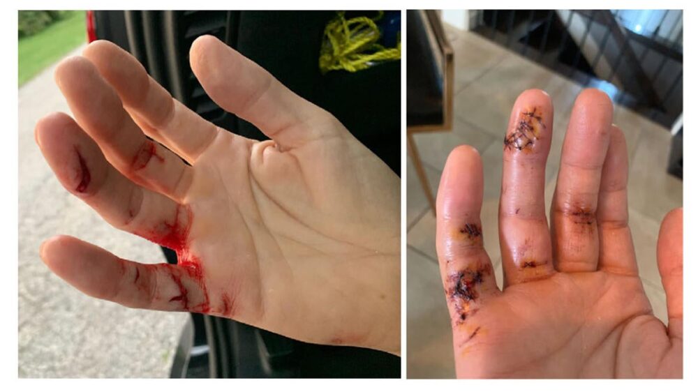 Muskie Attacks Swimmer Training for Triathalon - Wired2Fish