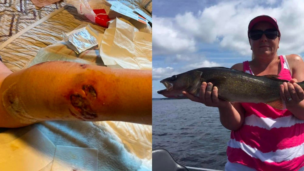 Woman Attacked by Big Musky - Wired2Fish